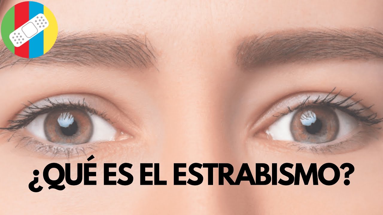 ¿QUÉ ES EL ESTRABISMO? - YouTube