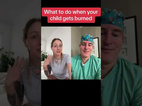 What to do when your child gets burned