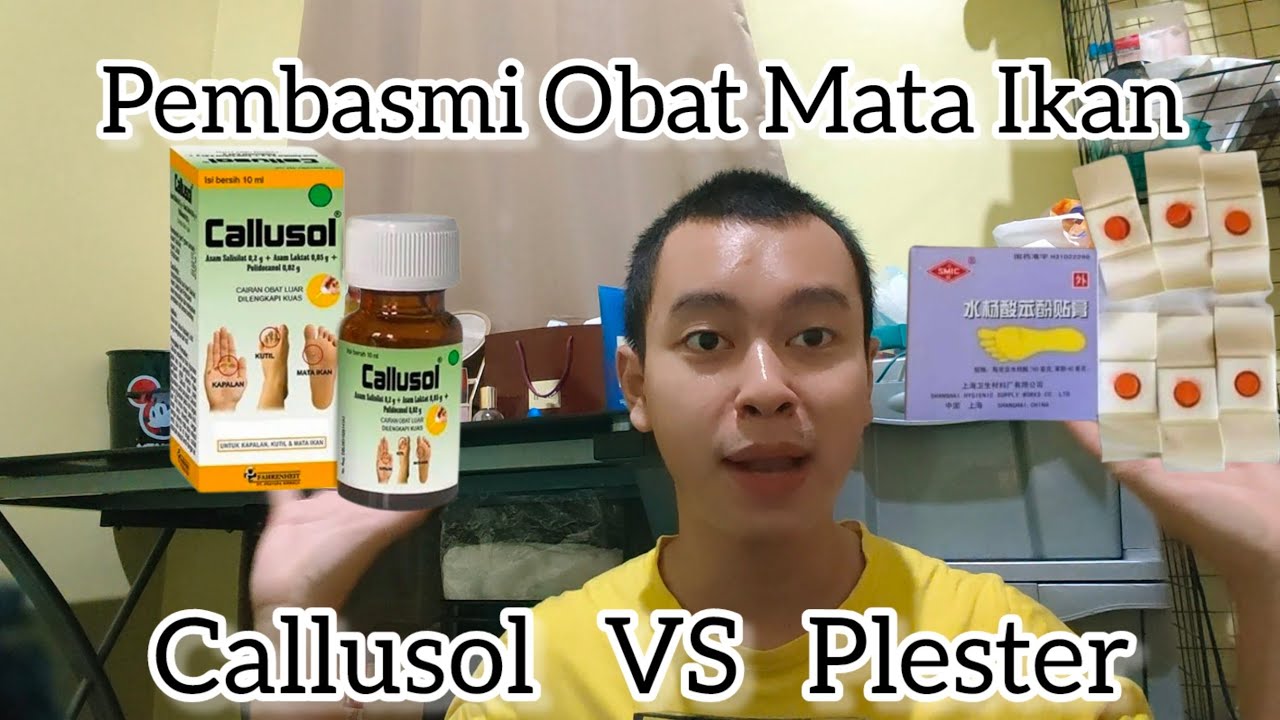 Review Obat Callusol & Plester, Mengobati mata ikan, kutil dan kapalan ...