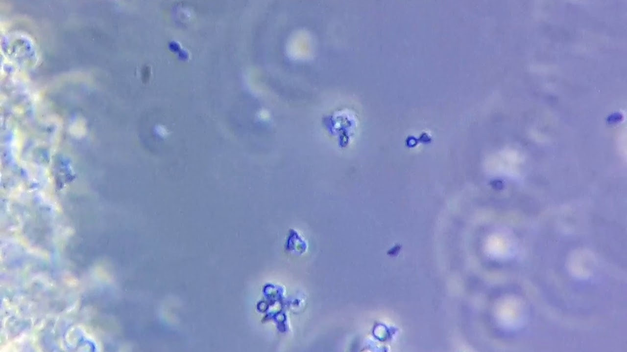 Бактерии в сметане. / Bacteria in sour cream. - YouTube