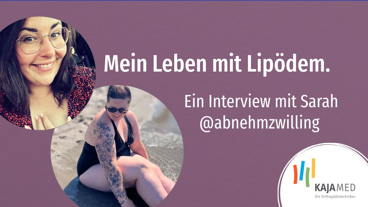 Mein Leben mit Lipödem ein Interview mit Sarah (Instagram ...