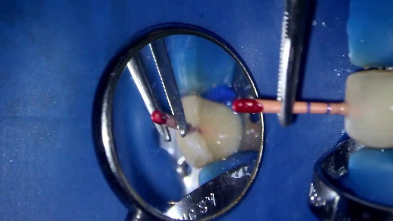 manual dynamic agitation - YouTube