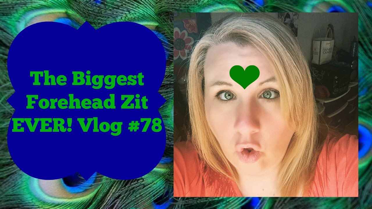 The Biggest Forehead Zit EVER! Vlog #78 - YouTube