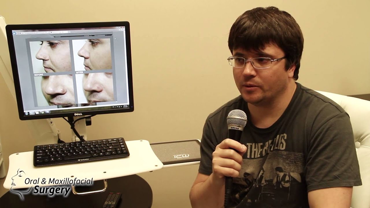 Interview With Dr Alexander V Antipov's Patient (Mole Removal) - YouTube