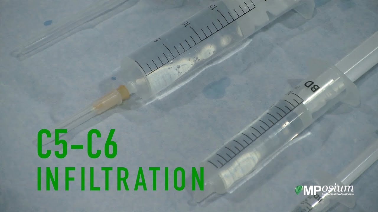 C5-C6 infiltration - YouTube