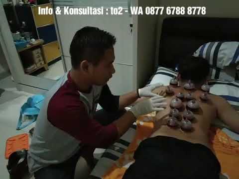 Terapi Bekam / Cupping Therapy di Bandung 0877 6788 8778 - YouTube