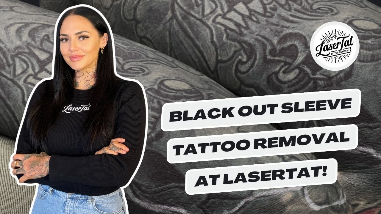 LaserTat Tattoo removal ADL. Blackout sleeve tattoo removal - YouTube