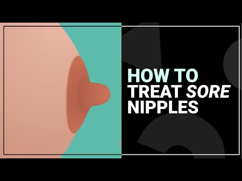 How to Treat Sore Nipples from Breastfeeding | Tinyhood