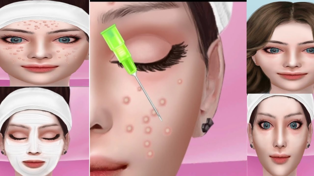 ASMR Acne removal skin care | Satisfying animation treatment for face ...