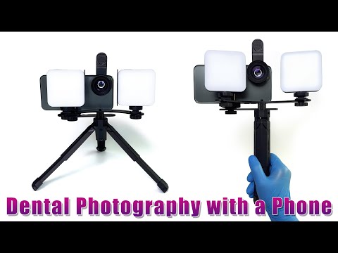 Dental photos with a mobile phone - MK-019 fill light for dentists - Tripod, Bluetooth, Macro lens