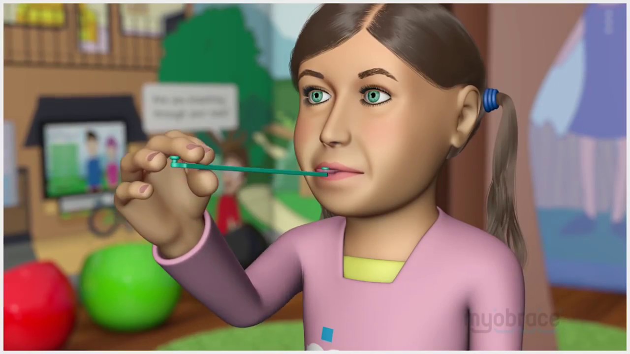 Lip trainer Myobrace - YouTube