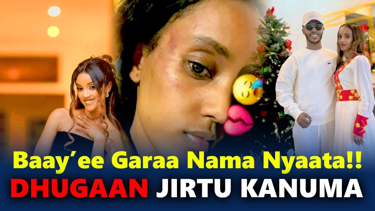 🔴Baay'ee Garaa Nama Nyaata Dhugaan Jirtu Kanuma #andualemgosa # ...