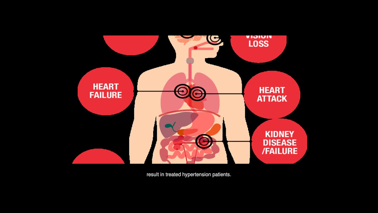 How Long Before An Untreated Blood Pressure Of 150 90 Can Harm You