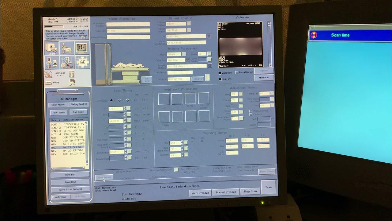 Liver MRI Quality Assurance Scan- GE MRI Scan - YouTube