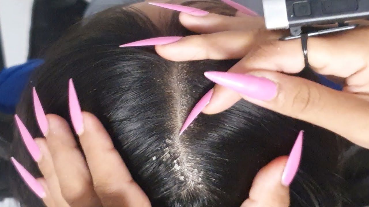 Real Dandruff & Scalp Check ASMR 💆‍♀️ | Long Hair + Deep Scratch ...