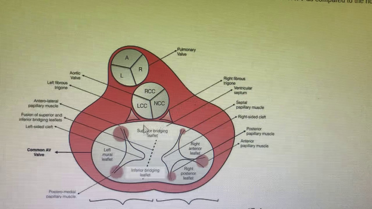 Details of AVCD 1 - YouTube