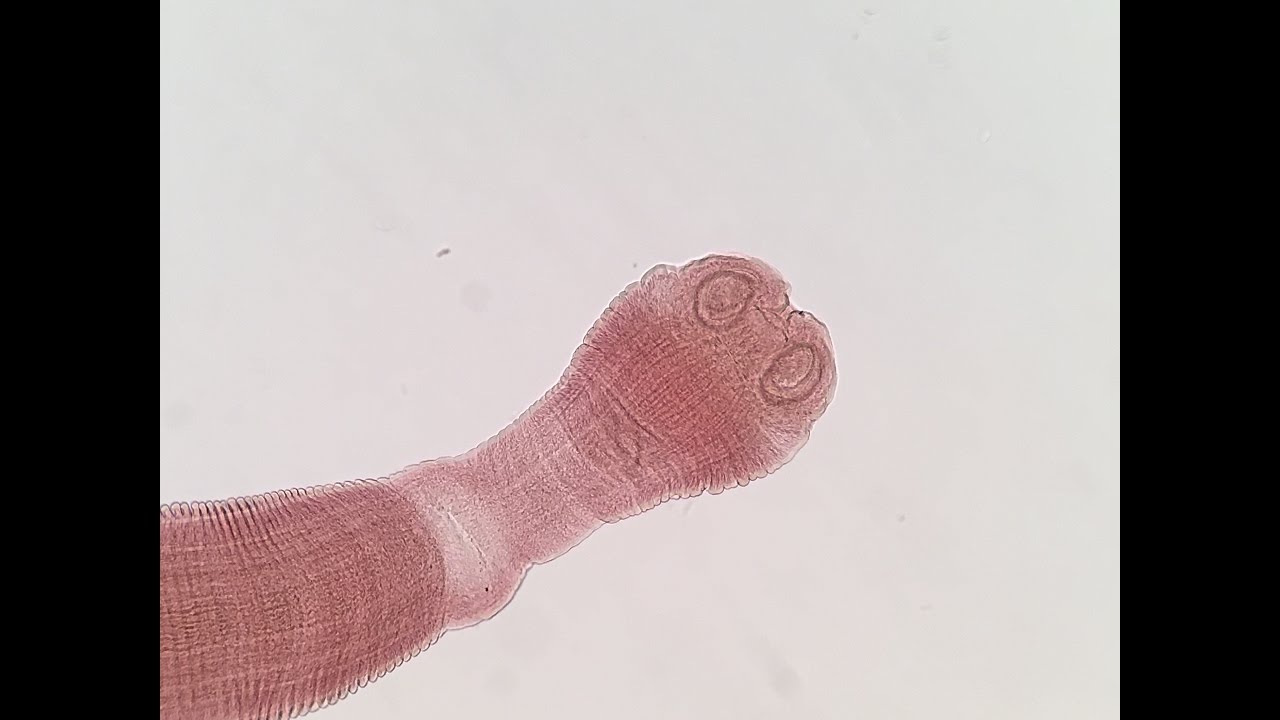 Raillietina echinobothrida - YouTube