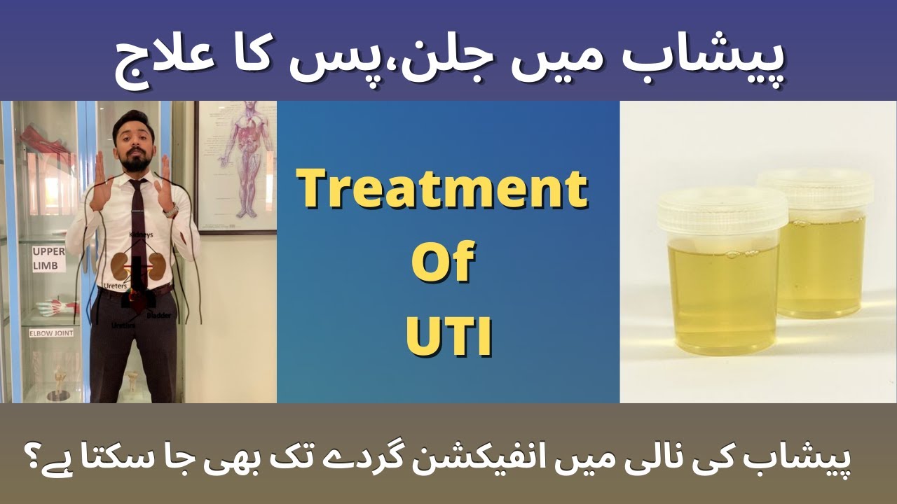 UTI ( pus or blood in urine ) Treatment | Urine Infection | peshab mein ...