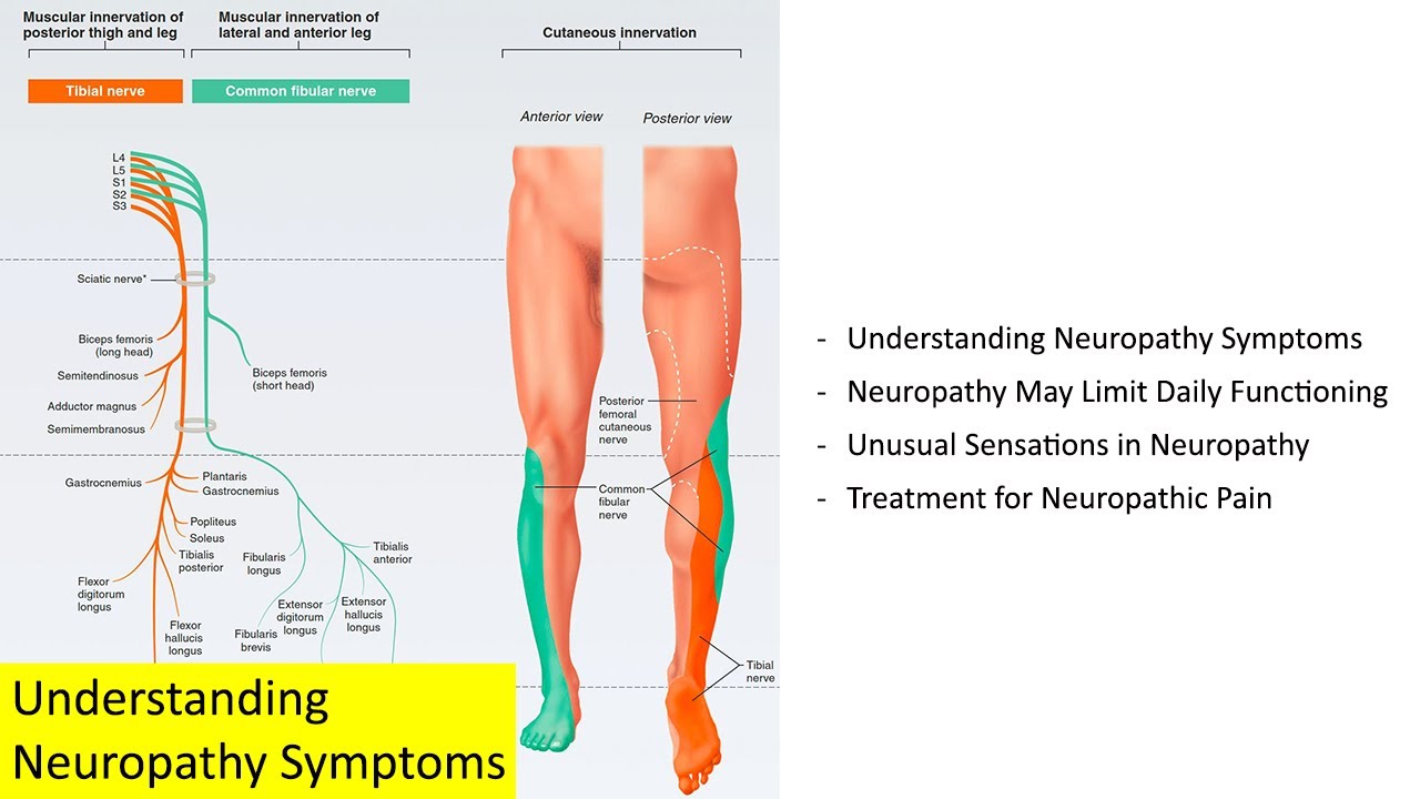 Understanding Neuropathy Symptoms - YouTube