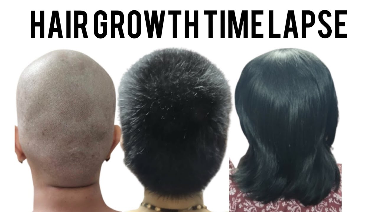 HAIR GROWTH TIME LAPSE - 1 YEAR - YouTube