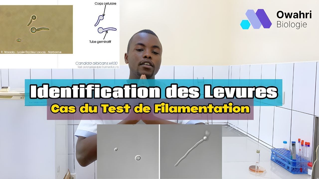 Comment Réaliser un Test de Filamentation : Tutoriel Pratique en ...