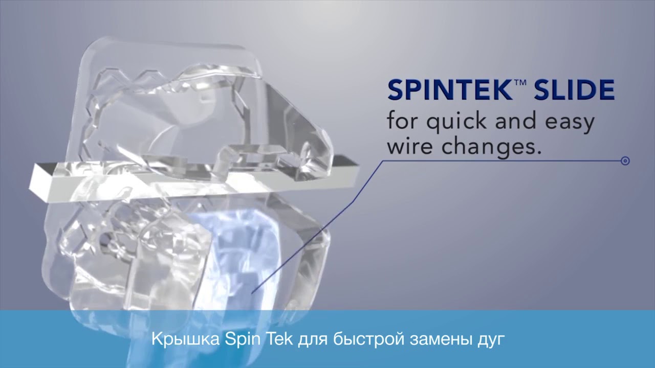 Новые керамические брекеты Damon Clear 2 в Клинике Конфиденция - YouTube