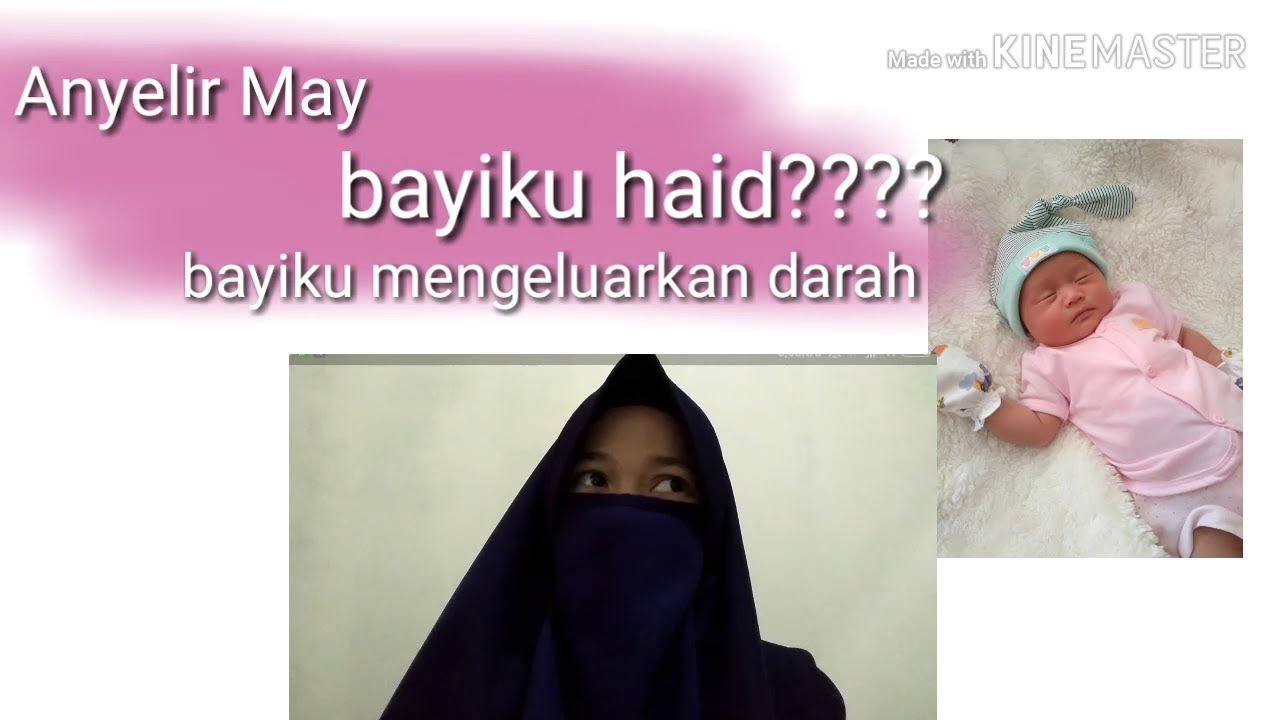 BAYIKU MENSTRUASI ??? || bayi baru lahir keluar darah dari kemaluannya ...