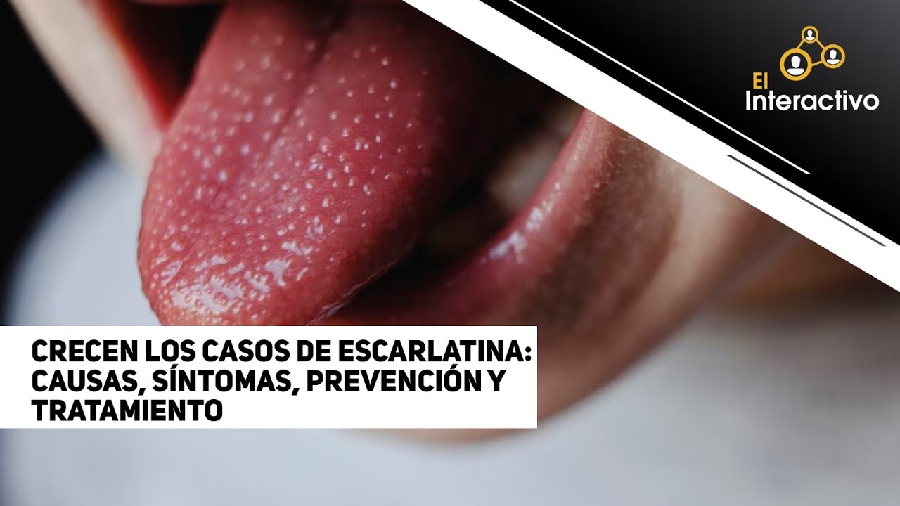 Crecen los casos de escarlatina: causas, síntomas, prevención y ...