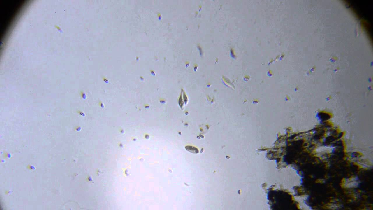 In una goccia d'acqua - Accoppiamento Lionotus cygnus - YouTube