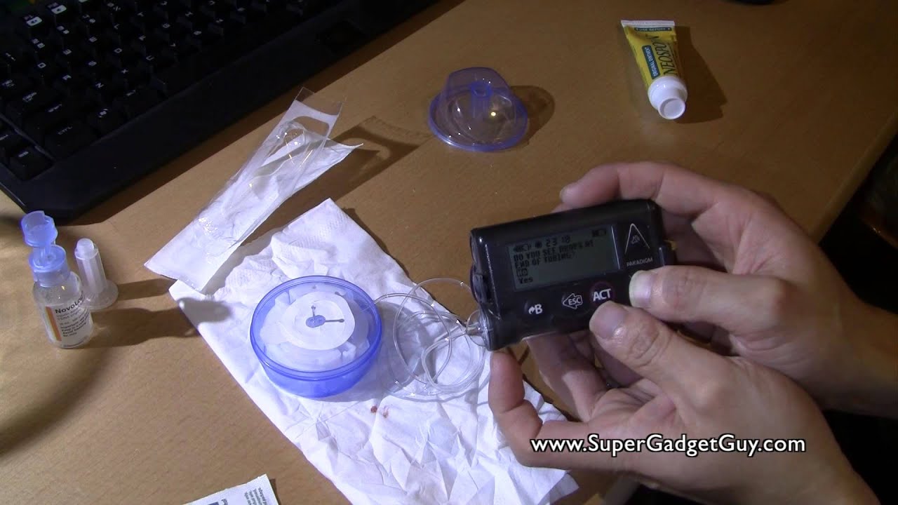 How I do an Insulin Infusion Set Change with Medtronic Minimed Pump and ...
