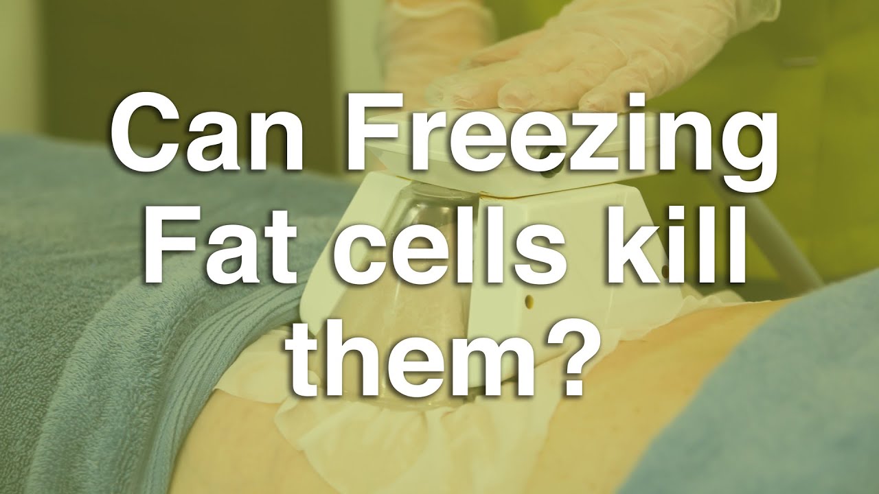 Can Freezing Fat cells kill them? | The Body Clinic | Fat Freezing FAQ ...