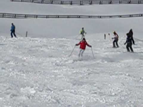 Michel Skiing with Prosthetic leg XT-9 (above the knee, left) - YouTube