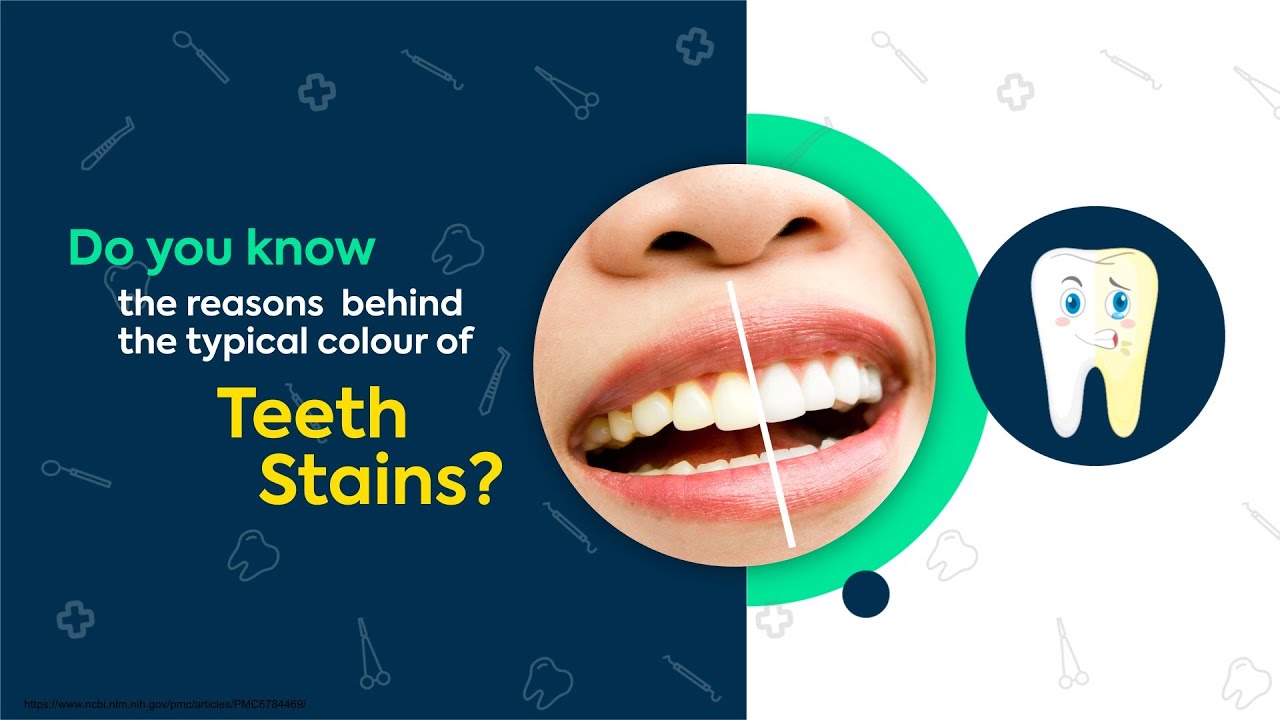 The Typical Colour of Teeth Stains & The Reason Behind Them - YouTube