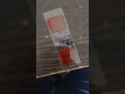 Blood test # Sickling test# - YouTube