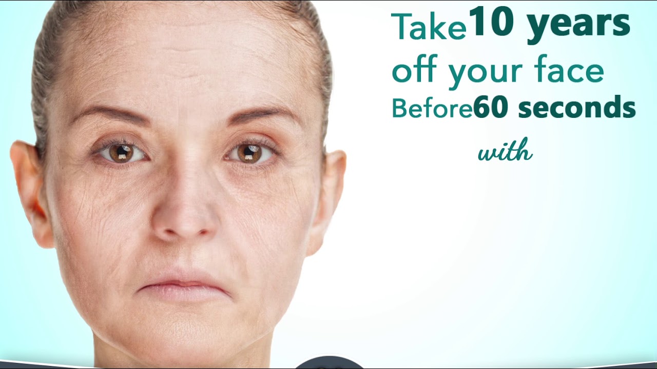 Take 10 years off your face with Botox Treatment - Square Root Skin ...