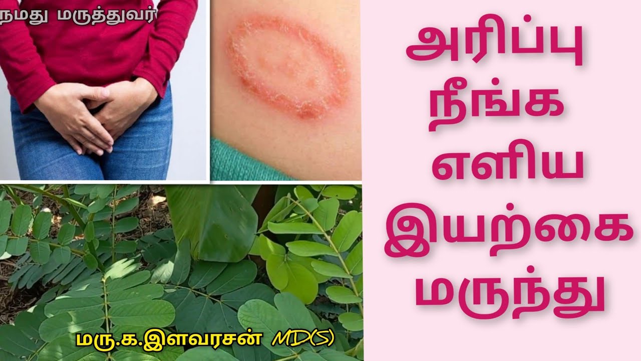 fungal infection in private parts in tamil || itching problem solution ...