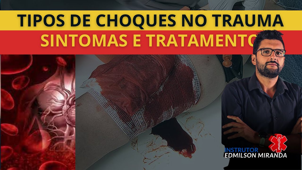 Principais tipos de choque sintomas e tratamento 2 - YouTube