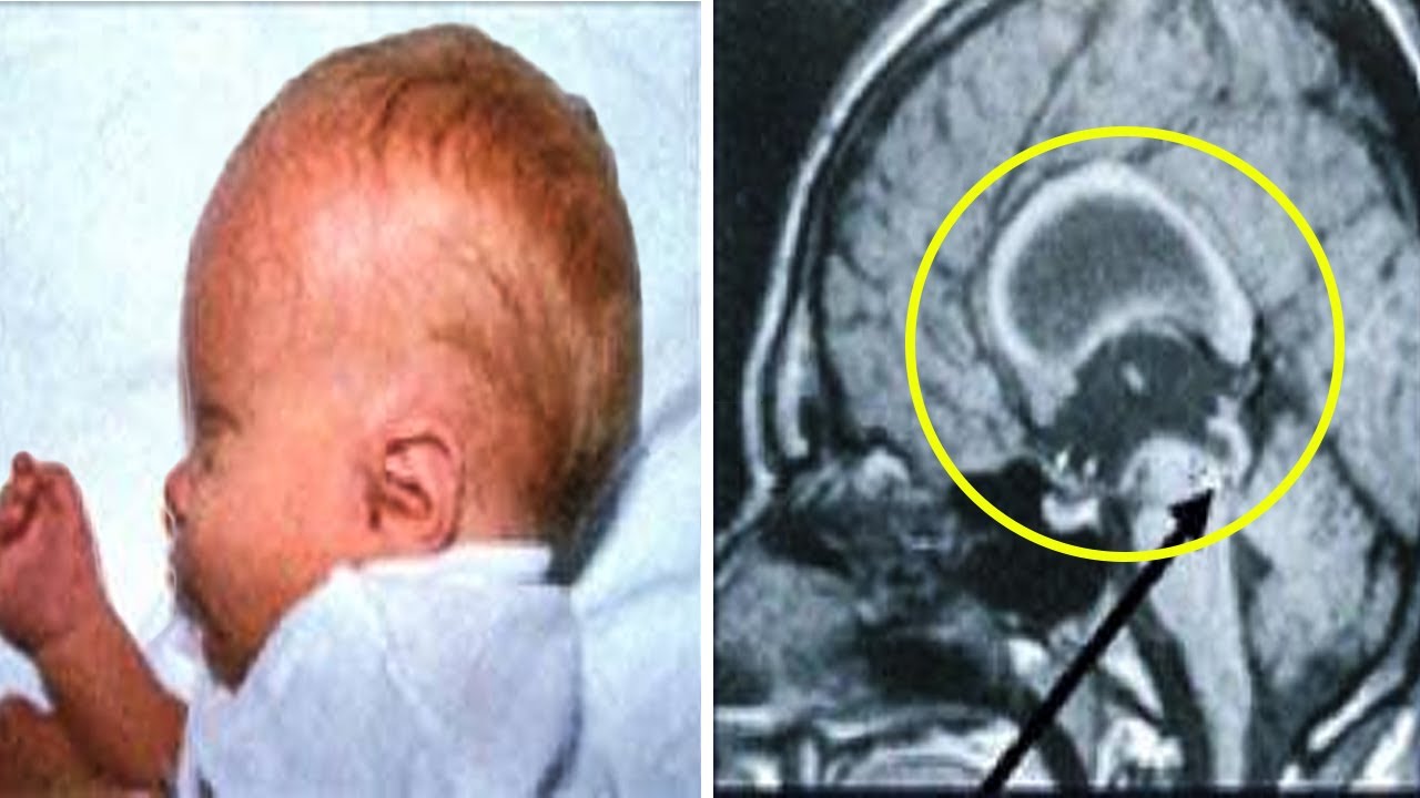 Doctors Uncover Mysterious Growth on Baby’s Head, Their Shocking ...