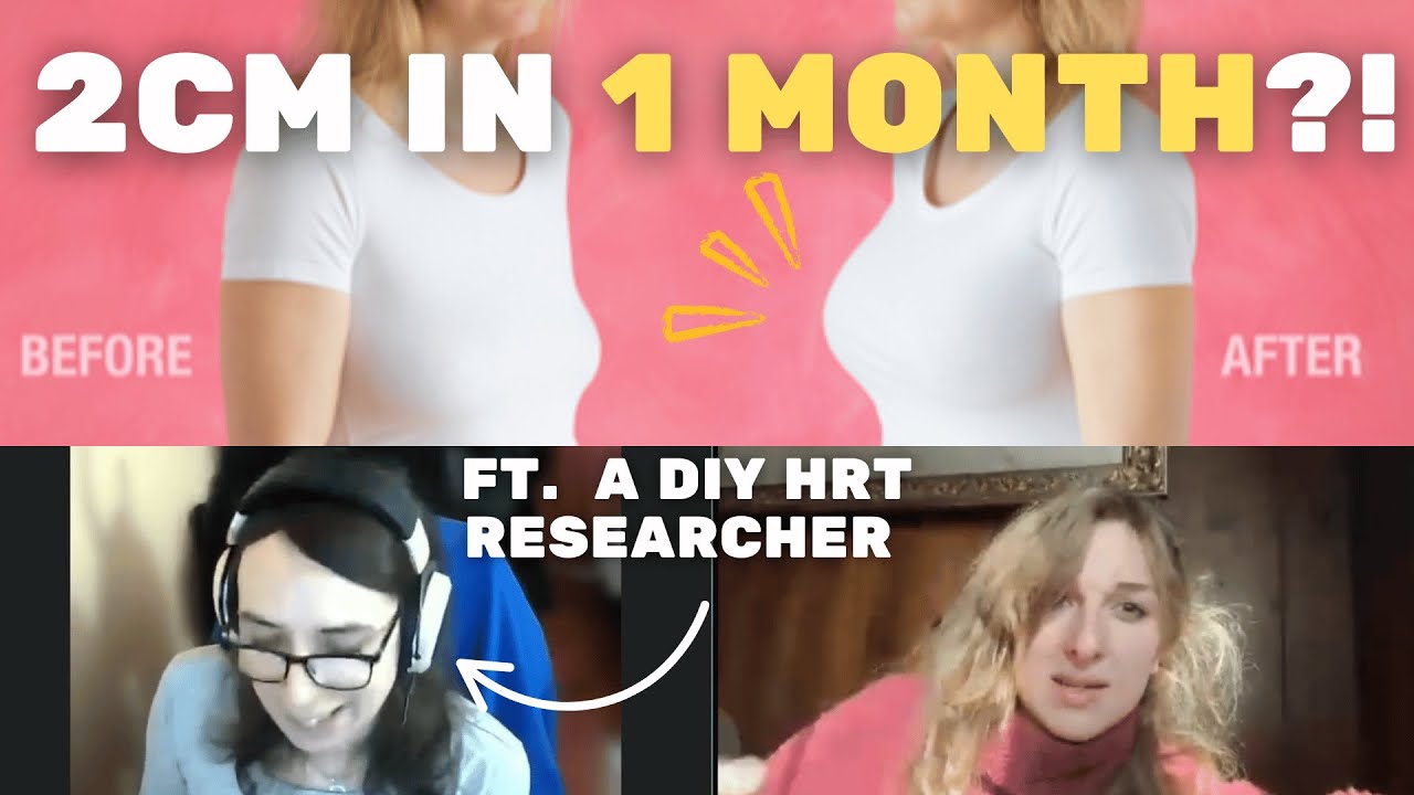 Bicalutamide & Early HRT Strategy: New Insights on Transgender Breast ...