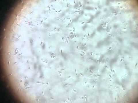 Espermatozoides vistos desde el microscopio - YouTube