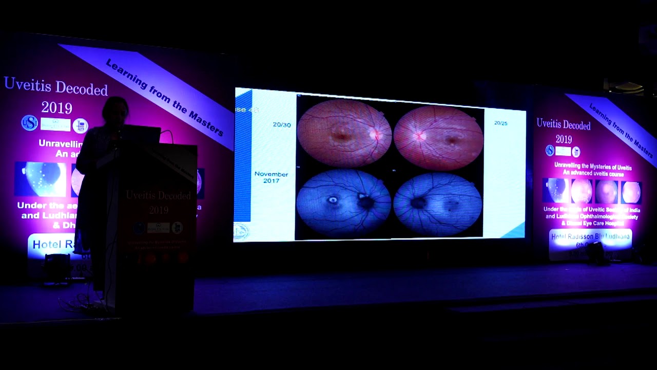 UVEITIS DECODED 2019:Prof Vishali Gupta - YouTube