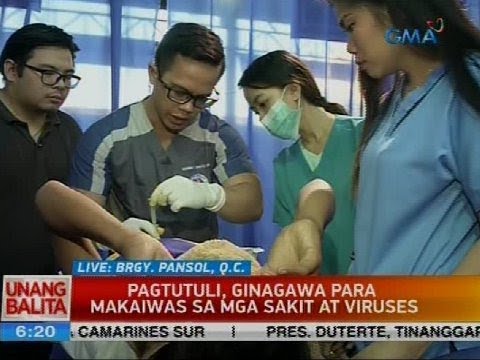 Serbisyong Totoo: Libreng tuli sa 100 bata - YouTube