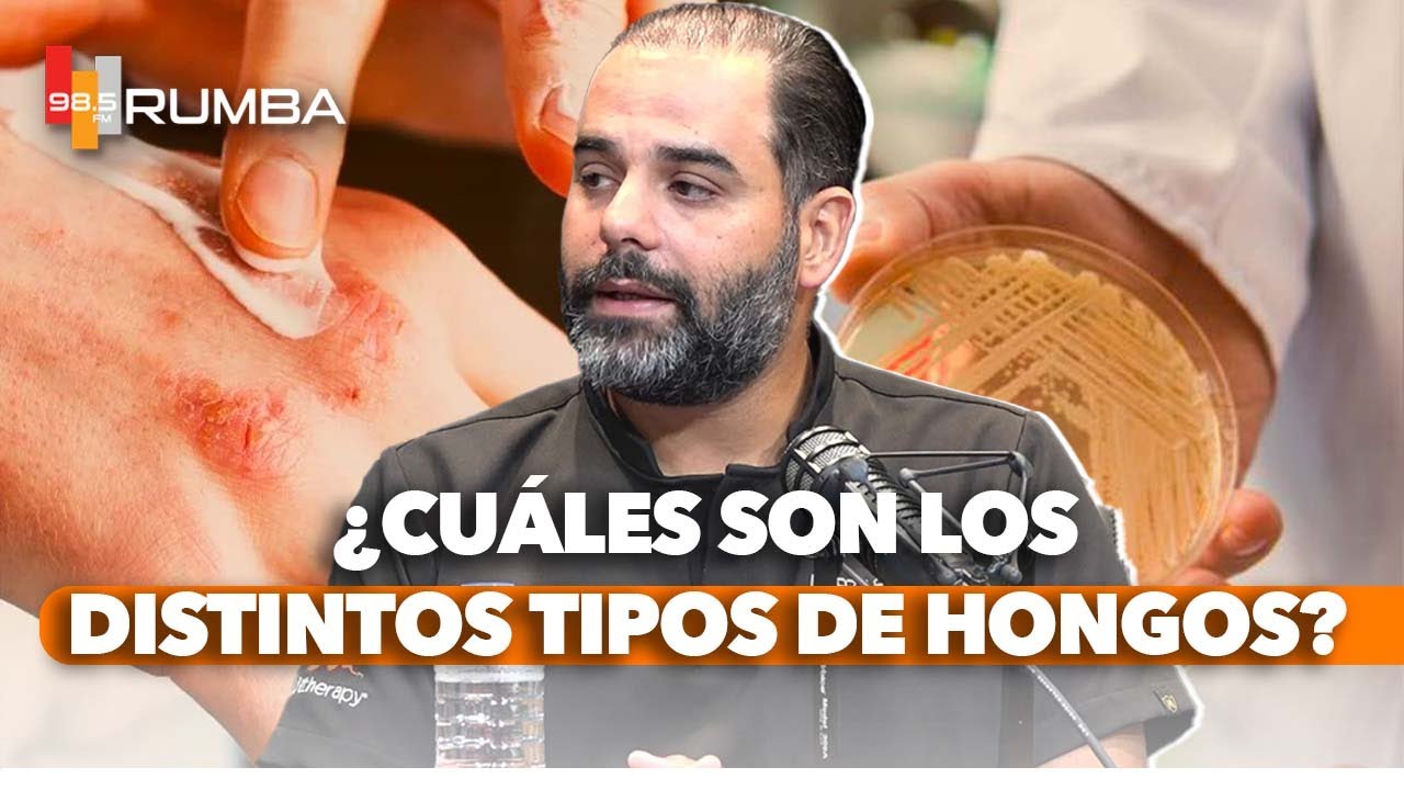 Una de las zonas favoritas de los hongos es el cuero cabelludo-Dr ...