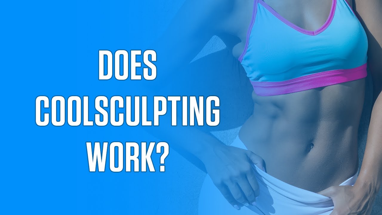 What Is CoolSculpting and Does It Work? (What 17 Studies Show) - YouTube