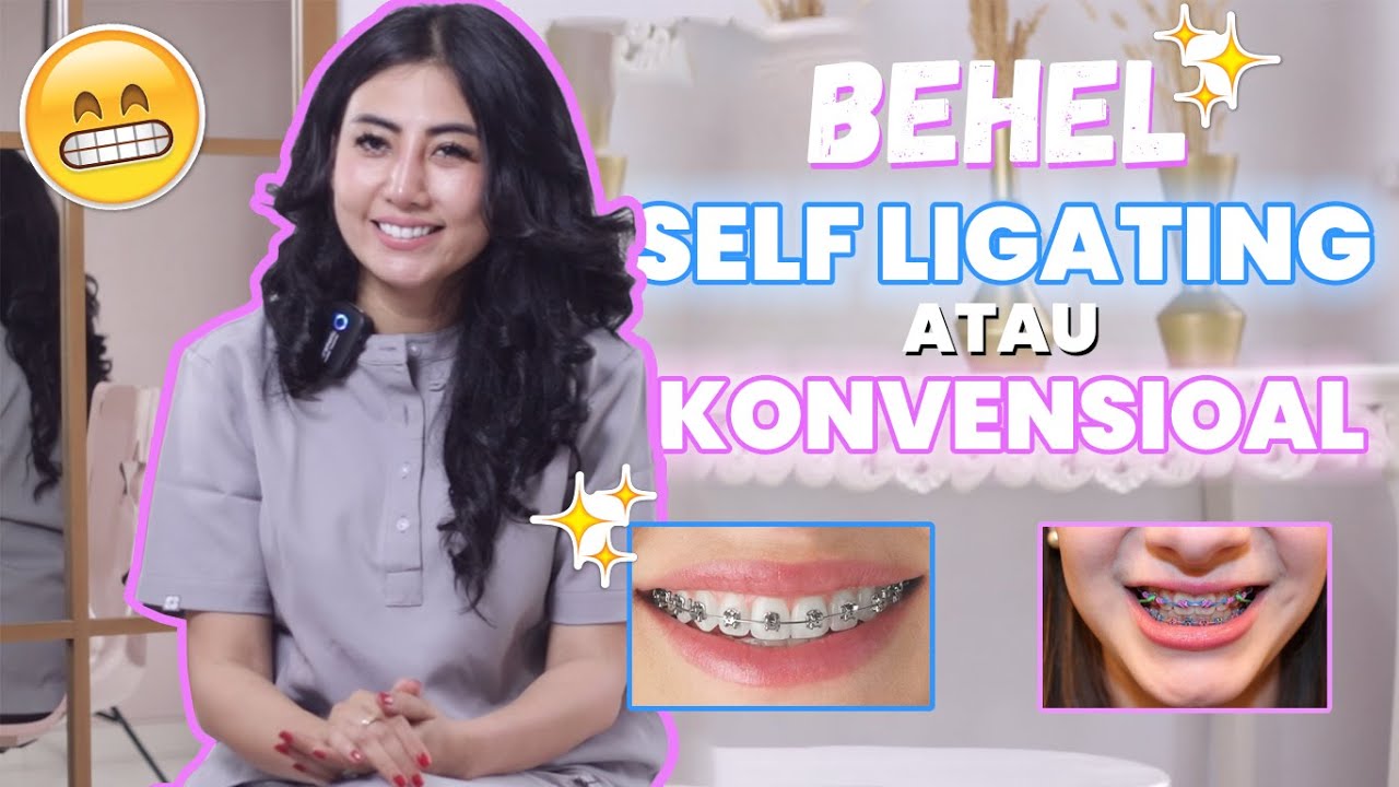 APA SIH BEHEL SELF LIGATING?? - YouTube