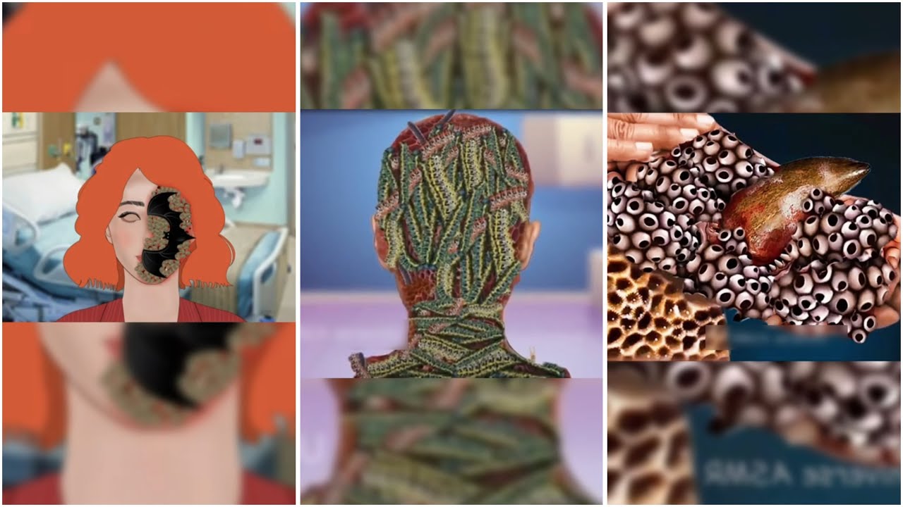 ASMR Worm Ep 649 - YouTube