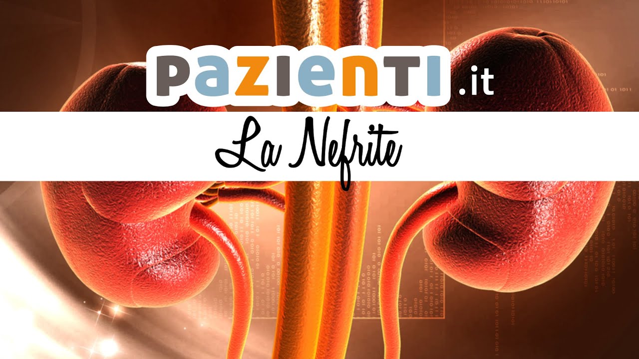 La nefrite: sintomi, cause e cure - YouTube