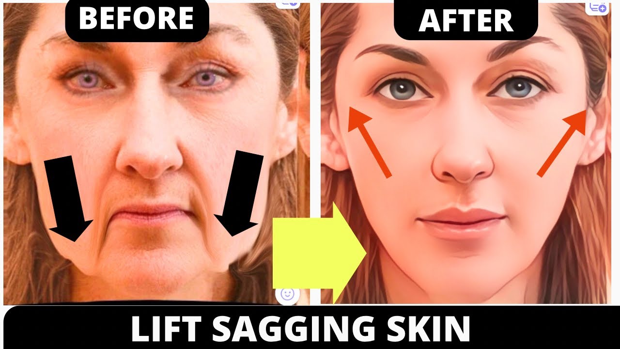 🛑 ANTI-AGING FACE LIFTING EXERCISES FOR SAGGING SKIN, JOWLS, LAUGH ...