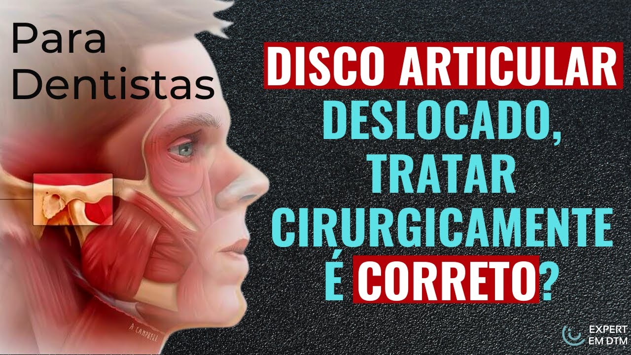 [DENTISTA] Disco articular deslocado, tratar cirurgicamente é correto ...