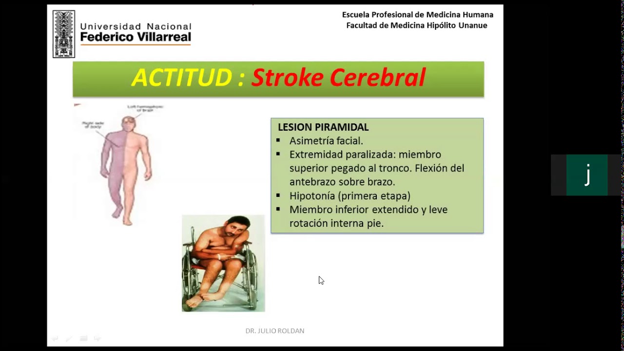 Facies, actitud y marcha 2 - YouTube